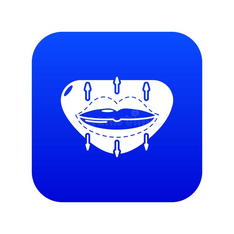 Lip Augmentation Icon, Cartoon Style. Stock Vector - Illustration of ...