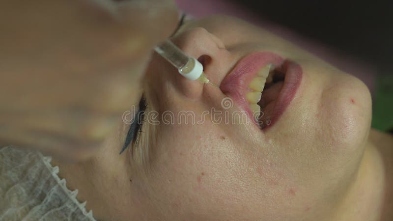 Lip Injection Procedure. Plastic Surgery. Stock Video - Video of ...