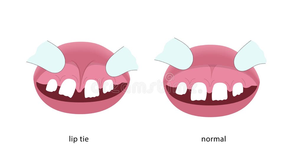 Lip Tie Stock Illustrations – 200 Lip Tie Stock Illustrations, Vectors ...