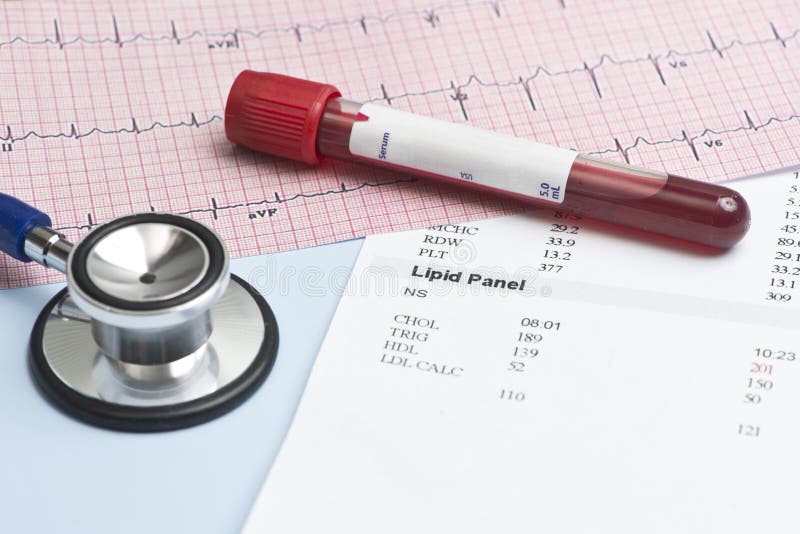 Lipid Panel EKG stock photo. Image of hospital, electrocardiogram ...