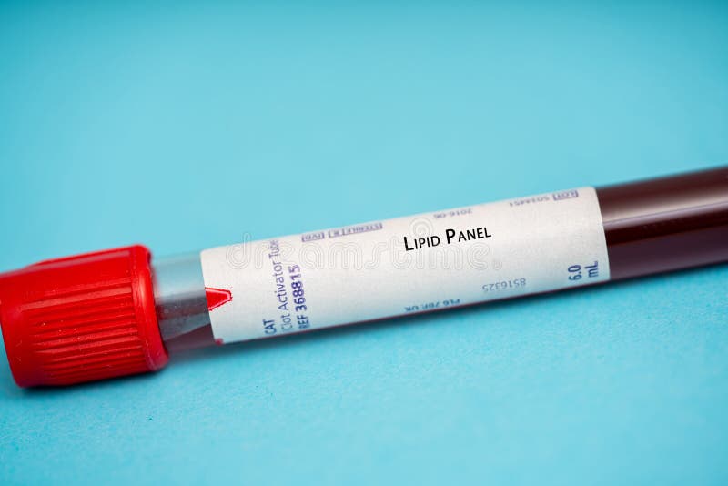 Lipid Panel stock photo. Image of panel, cholesterol - 278114162