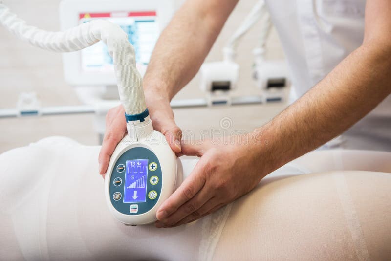 Lipolisis Del Laser Del Procedimiento Imagen de archivo - Imagen de ...