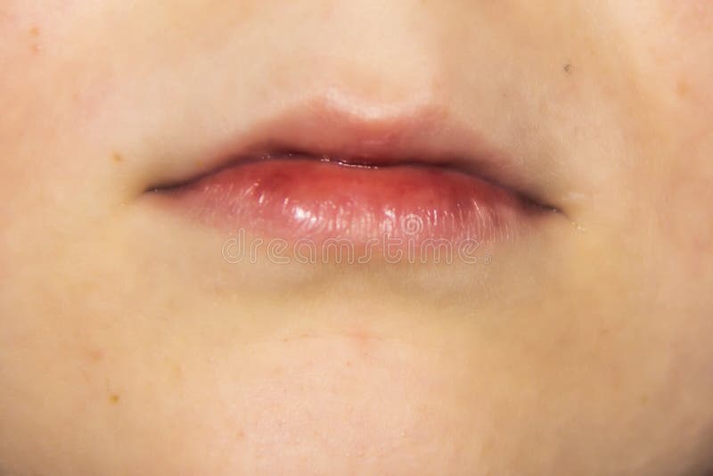 A Lips of a Boy. a Part of Face of Kid. a Skin Background Stock Photo ...