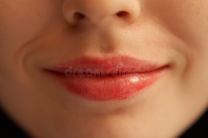 Close Up, Woman with a Red Nose, Allergy, Hypothermia or Rosacea Stock ...