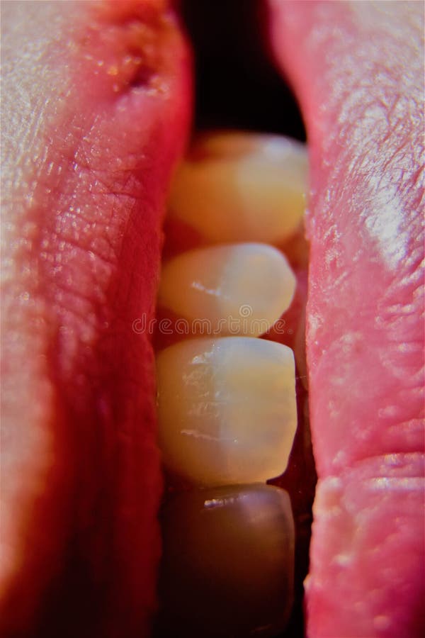 Lips with Visible Teeth of a Woman Stock Image - Image of helathly ...