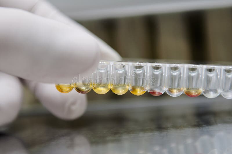 Liquid samples stock photo. Image of bacterium, equipment - 25327184