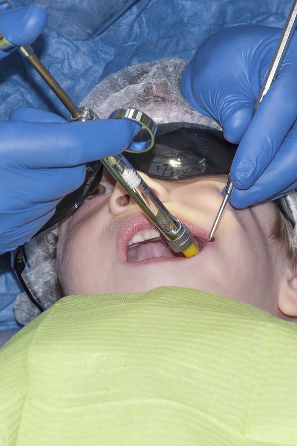 The Little Boy is Given an Injection of Anesthesia before Dental ...
