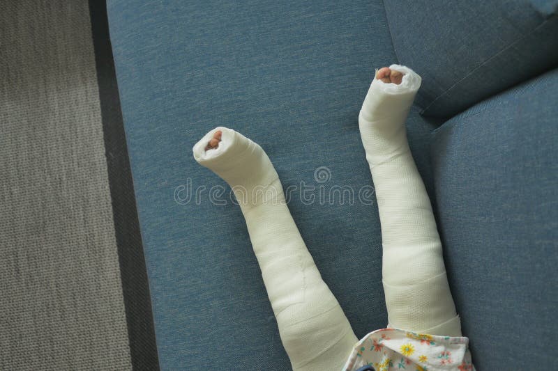 Little Child with Plaster Bandage on Leg. Stock Image - Image of joint ...