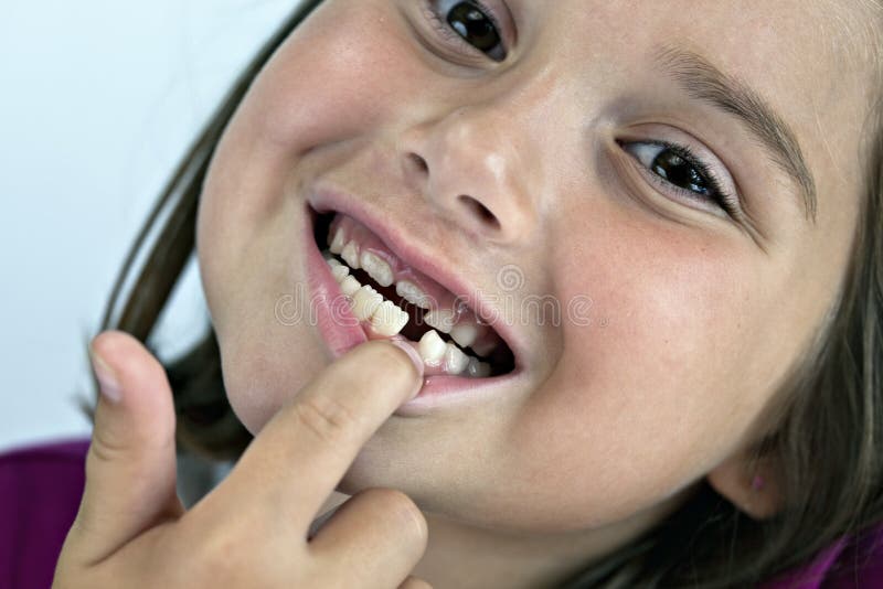 Little Girl with Lost Tooth Stock Photo - Image of seven, hair: 11917304
