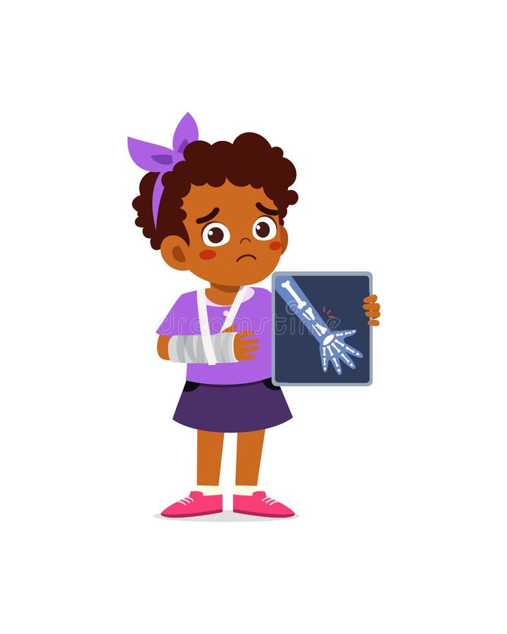 Little Kid Got Accident and Got Bone Fracture Stock Vector ...