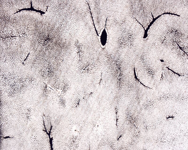 Liver. Blood vessels stock image. Image of histology - 268579753