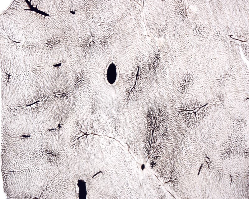 Liver. Blood vessels stock image. Image of central, light - 268579761