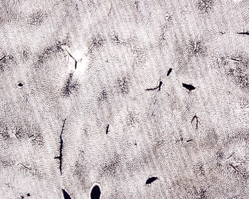 Liver Sinusoids Stock Photos - Free & Royalty-Free Stock Photos from ...