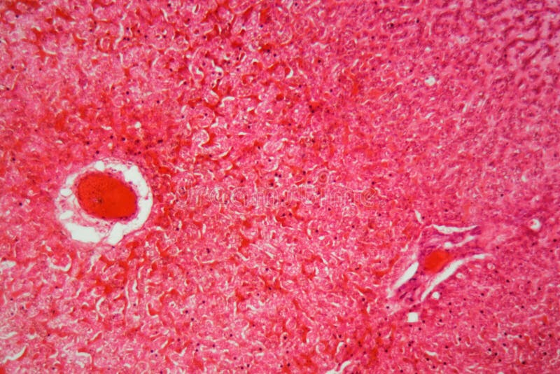 Liver Cells Under the Microscope Stock Image - Image of biology ...