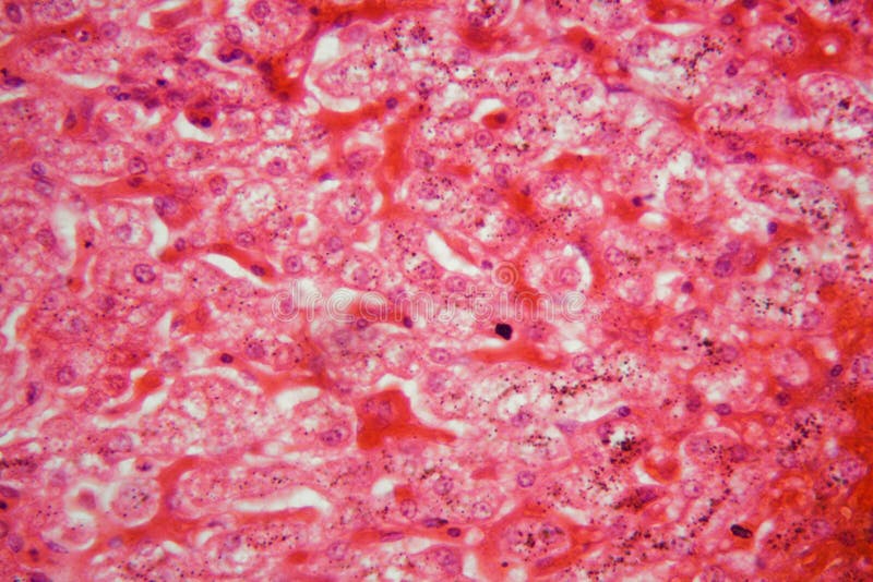 Liver Cells Under the Microscope Stock Photo - Image of hematoxylin ...