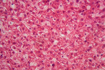 Liver Cells Under the Microscope Stock Photo - Image of haematoxylin ...