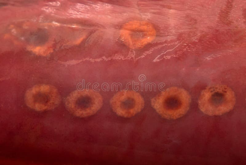 Liver with Circular Spots Depicting Liver Disease. Stock Image - Image ...