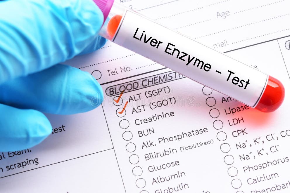 Liver enzyme test stock image. Image of medical, enzyme - 115061883