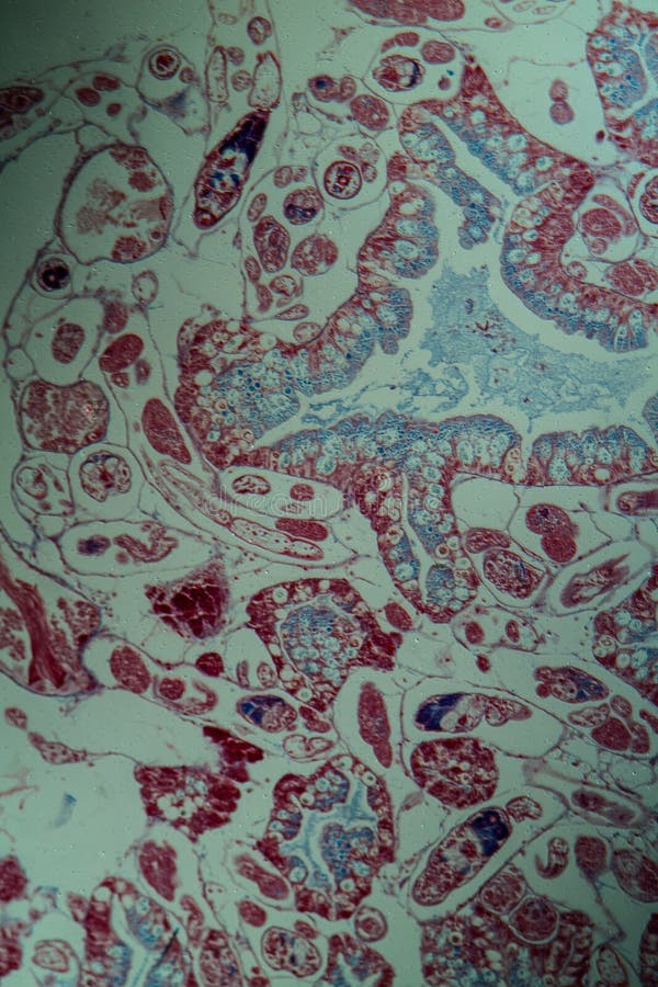 Liver fluke in water 100x stock photo. Image of microscope - 190738718