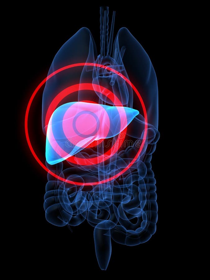 Hip inflammation stock illustration. Illustration of osteoporosis - 3546214