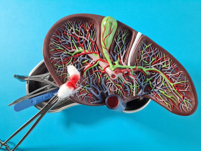 Liver Resection for Cancer and General Principles of Liver Surgery ...