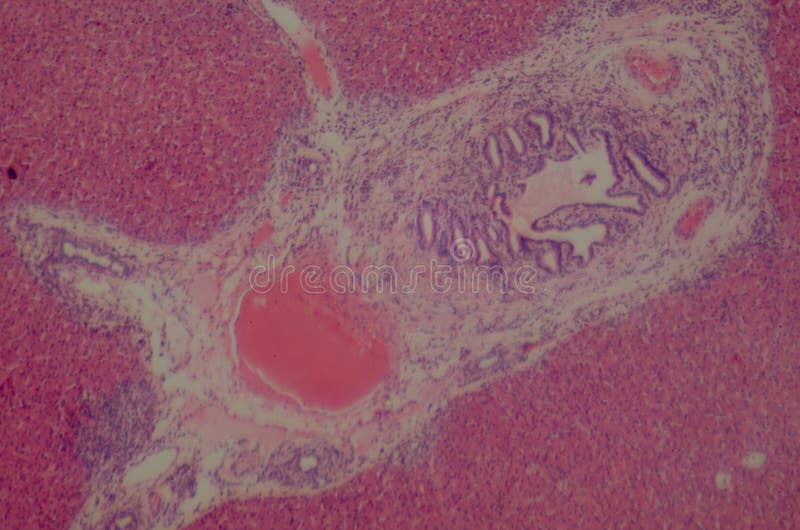 Polyploid nuclei stock photo. Image of microscopy, digestive - 93292232