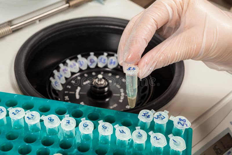 Loading DNA Samples for PCR Stock Photo - Image of polymerase, polymer ...