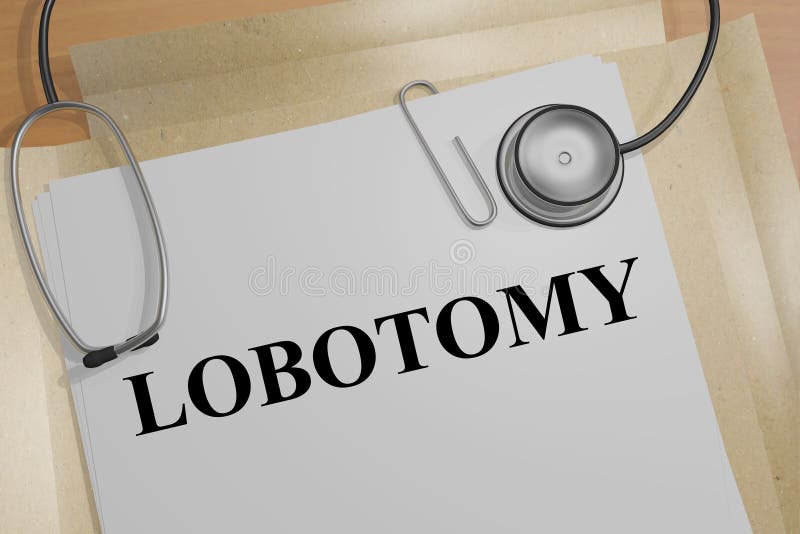 LOBOTOMY - medical concept stock illustration. Illustration of medicine ...