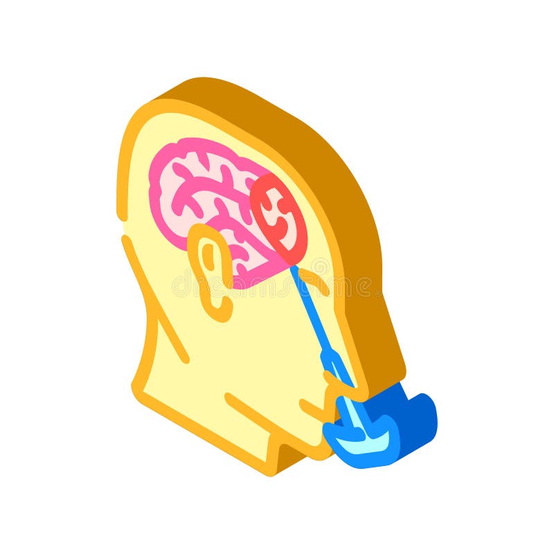 Lobotomy Surgery Isometric Icon Vector Illustration Stock Illustration ...