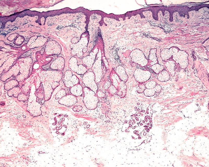 Reticular Dermis. Human Skin Stock Image - Image of tissue, connective ...