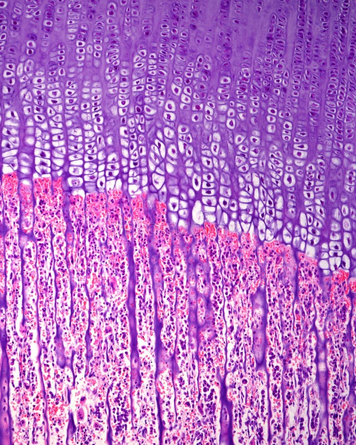 Long Bone Ossification. Epiphyseal Growth Plate Stock Image - Image of ...