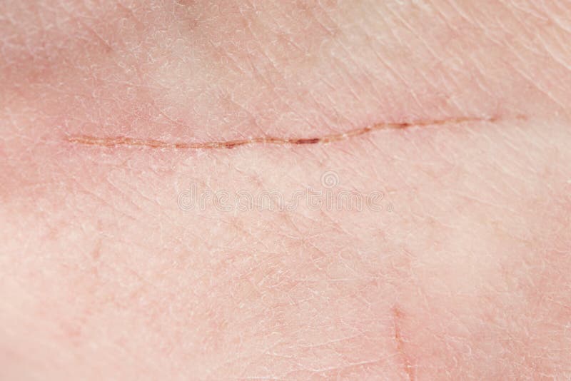 46+ Long cut skin Free Stock Photos - StockFreeImages