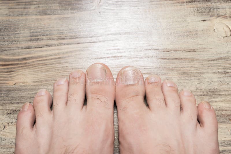 Long Nails on the Man`s Legs Stock Image - Image of heel, caucasian ...