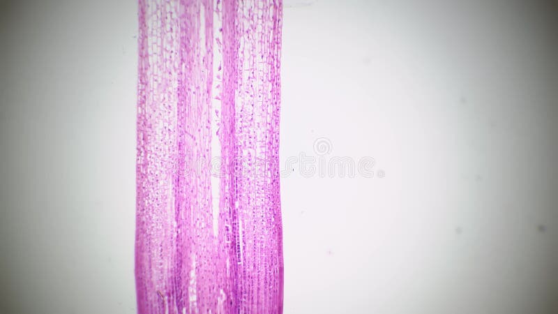 Longitudinal Section of Human Tongue Showing Filiform Papillae Under ...