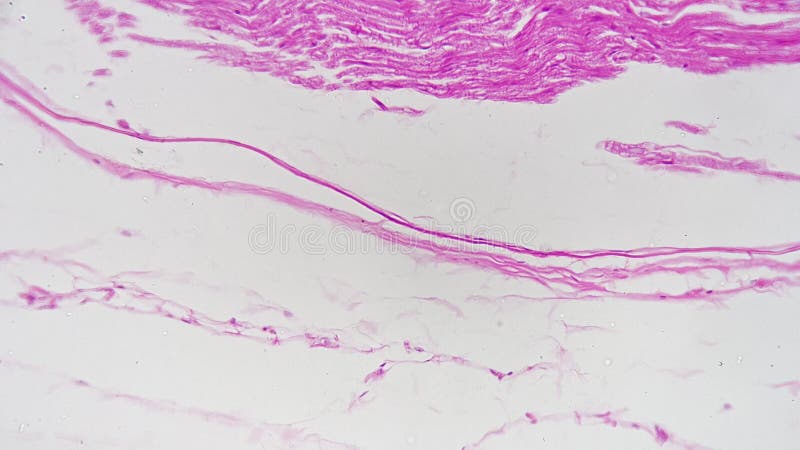 Longitudinal Section of Human Being Nerves Trunk Under Microscope 200x ...