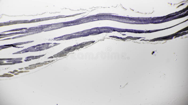 Longitudinal Section of Human Tongue Showing Filiform Papillae Under ...