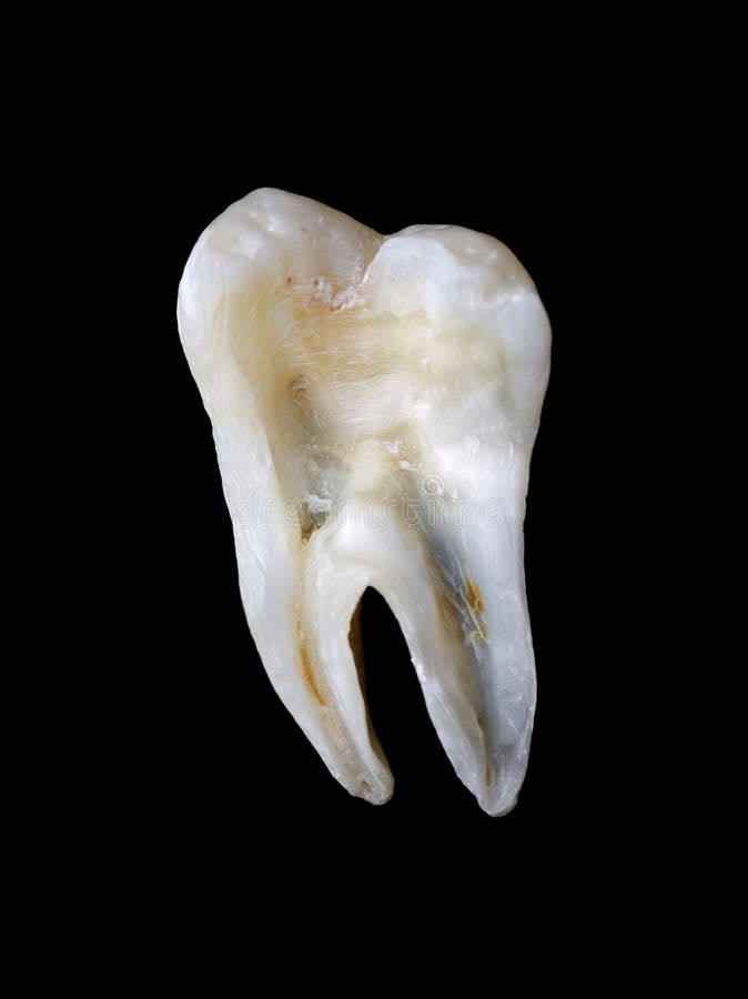 Longitudinal Section from a Human Tooth Stock Image - Image of macro ...