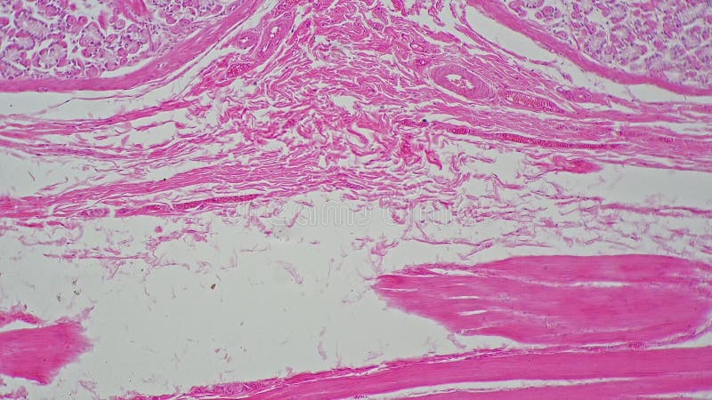 Human Kidney with Blood Vessel Injected in Section Filmed Under ...