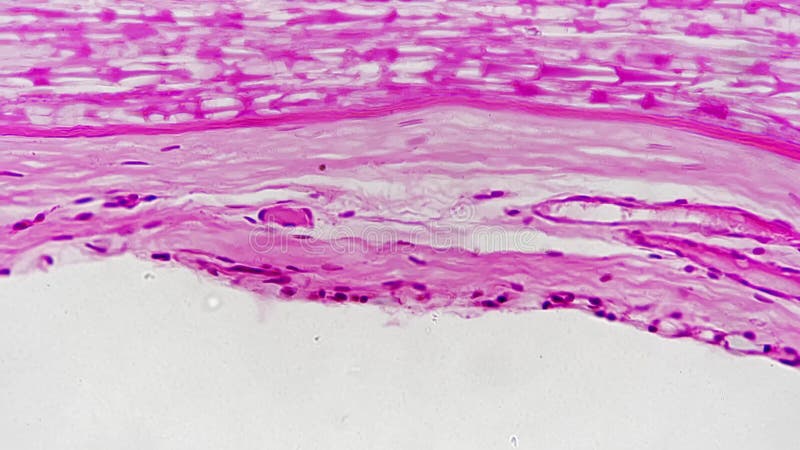 Longitudinal and Transversal Section of Human Nerves Trunk in High ...