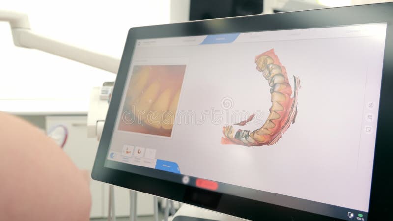 Scanning of the Dental Jaw. Male Patient Undergoing Panoramic X-ray ...