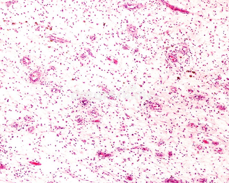 Connective Tissue Blood