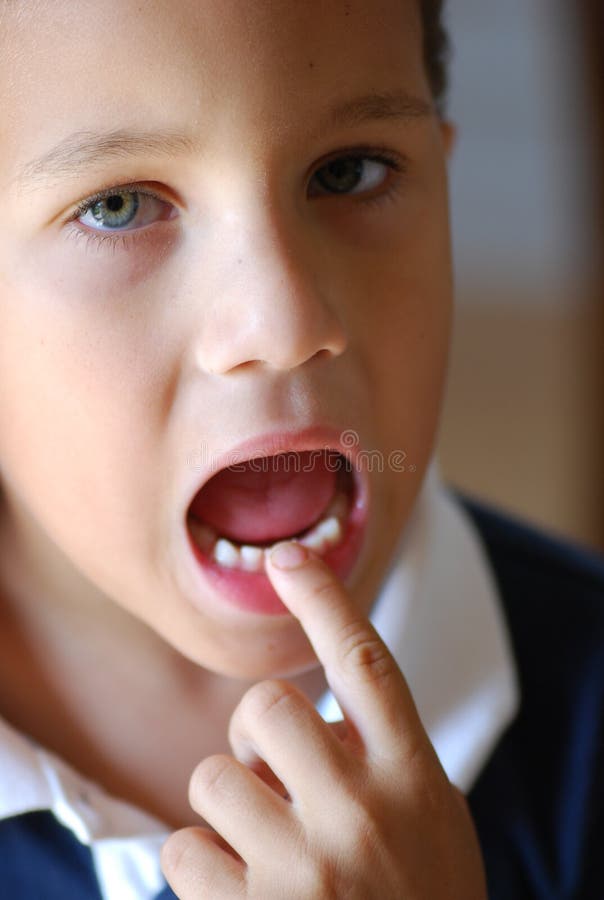 Loose Tooth stock photo. Image of white, dentist, teeth - 5310838