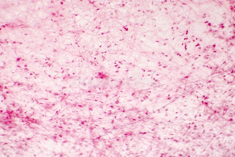 Los bindweefsel stock foto. Afbeelding bestaande uit microscopy - 117240176