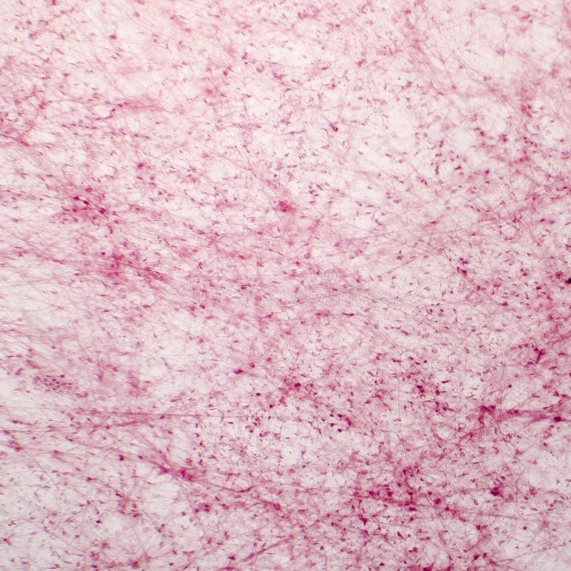 Los bindweefsel stock foto. Image of microscoop, biologie - 117240176