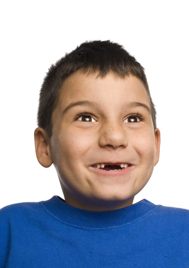 Lost two front teeth stock photo. Image of dentist, face - 20914688