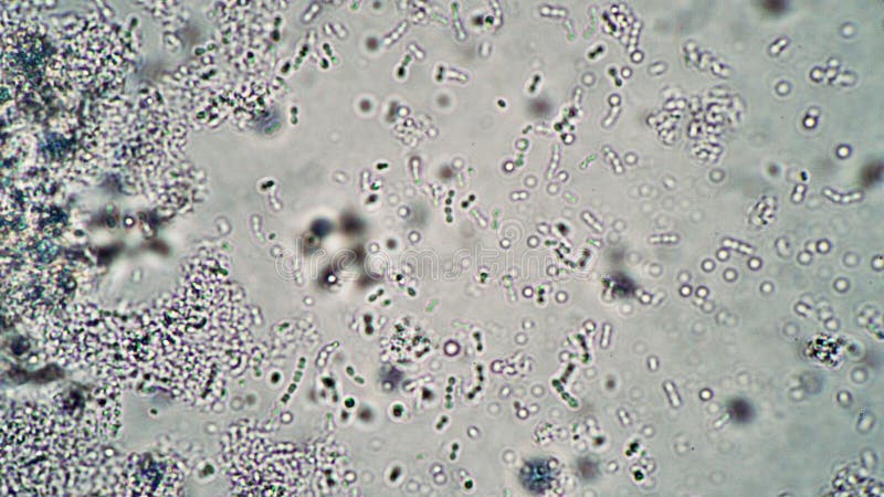 A Lot of Bacteria and Bacilli in a Drop of Ferment for Fermented Milk ...
