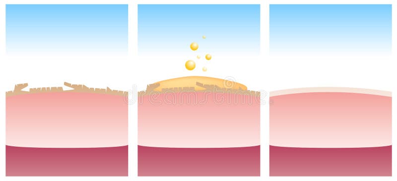 Lotion that Delete Dead , Bad Skin and Make the Skin Smooth Stock ...