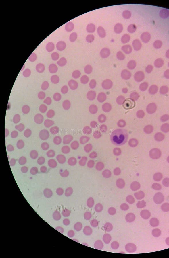 Love Shaped White Blood Cells Stock Photo - Image of heart, leukocytes ...