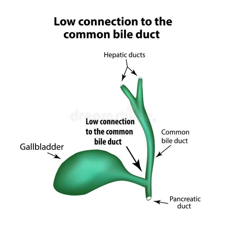 Common Bile Duct Stock Illustrations – 354 Common Bile Duct Stock ...