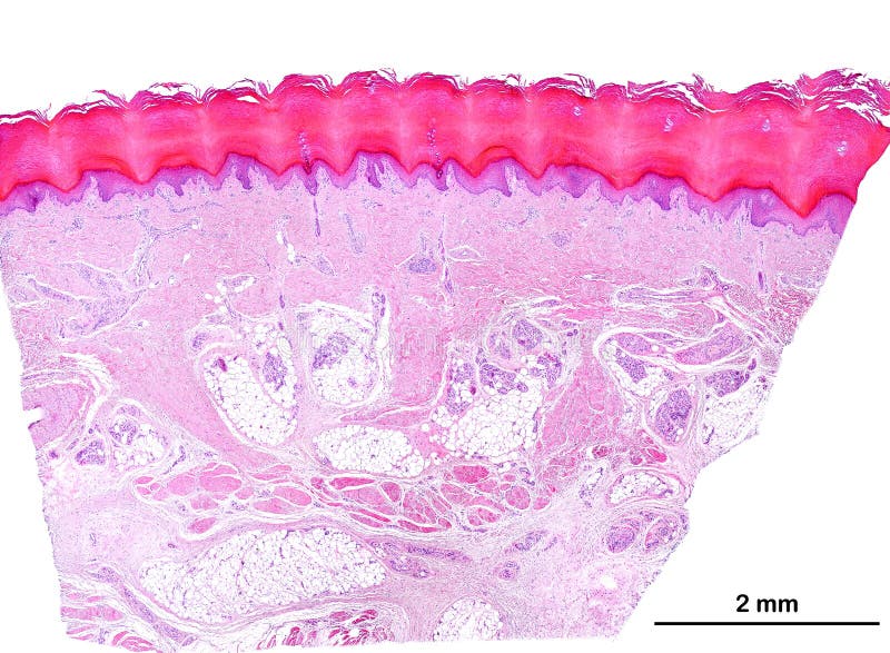 Human Thick Skin. Sole of the Foot Stock Photo - Image of microscope ...